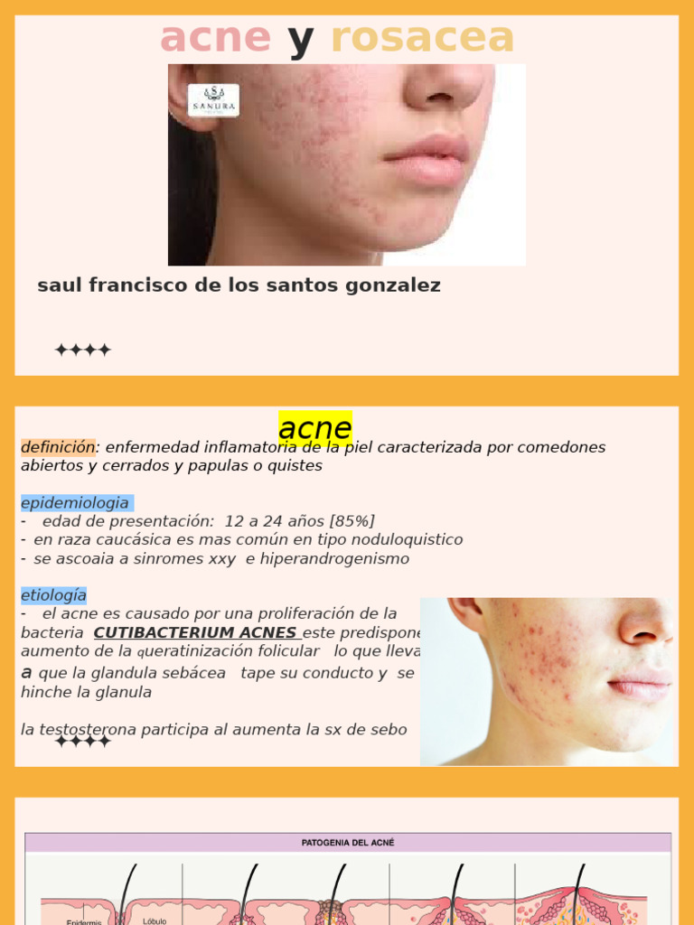 Acne y Rosacea | PDF | Enfermedades y trastornos | Medicina CLINICA