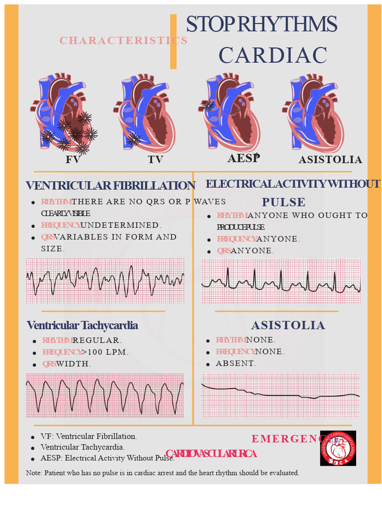 Understanding Cardiac Rhythms and Emergencies | PDF