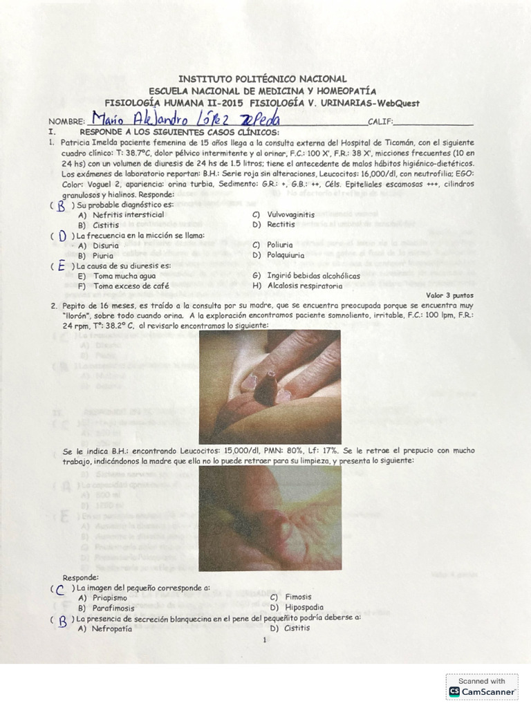 WQ - Renal - López - Zepeda - Mario | PDF