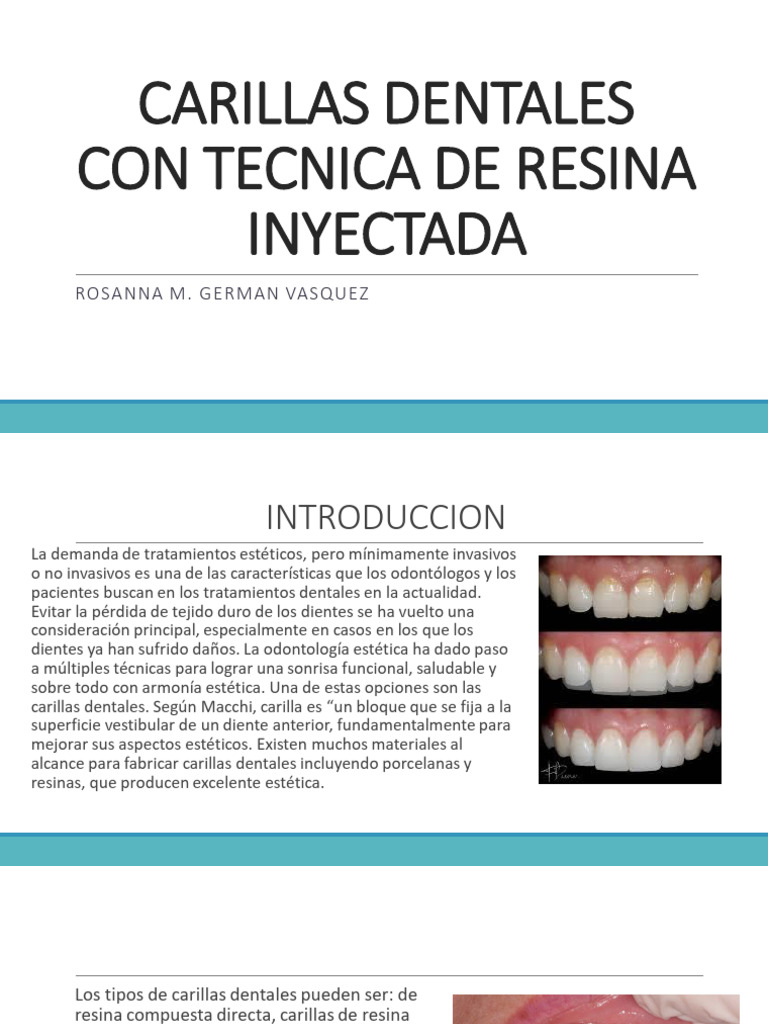 Carilla Con Tecnica de Resina Inyectada | PDF | Odontología | Ramas de ...