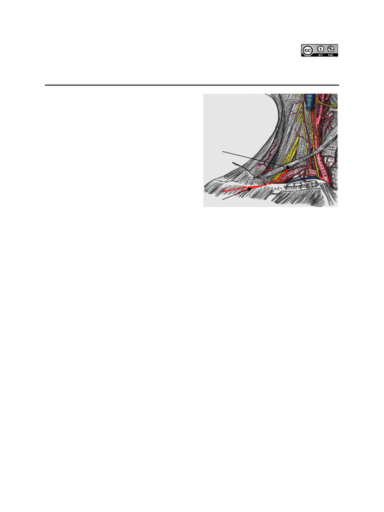 Supraclavicular Flap For Head - Neck Reconstruction | PDF | Vein | Neck