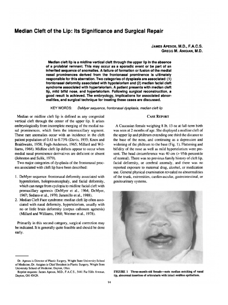 Median Cleft of The Upper Lip Significance | PDF