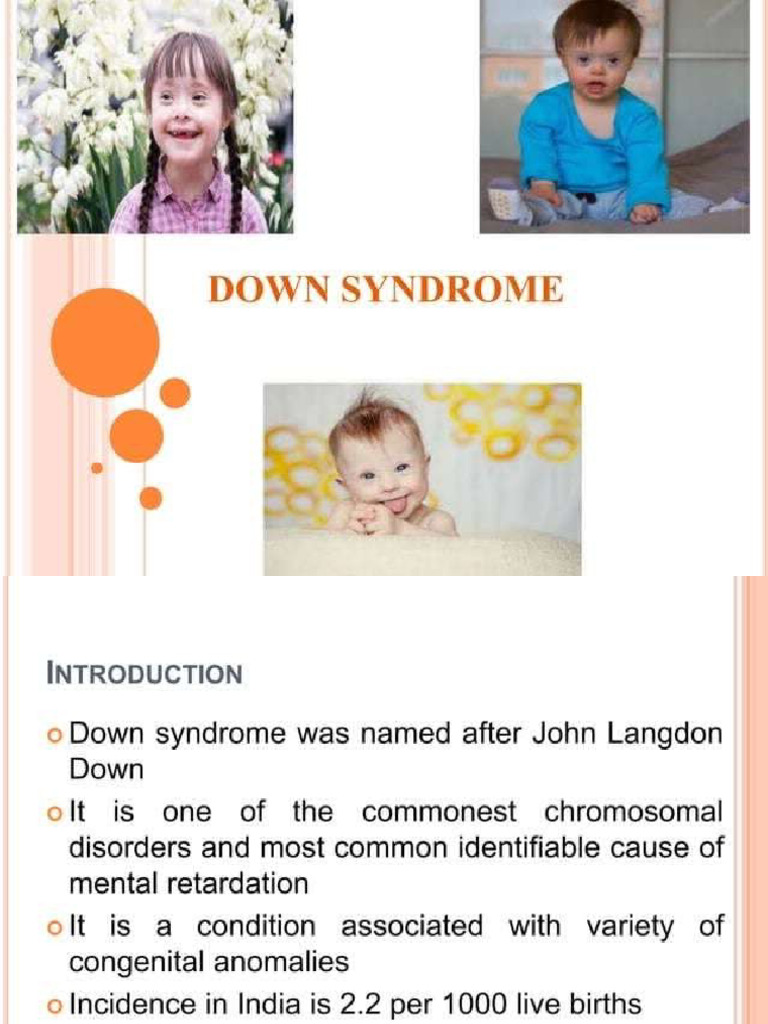 Down Syndrome | PDF