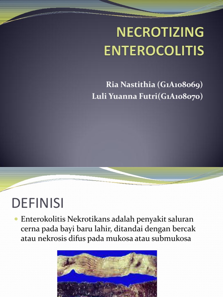 Necrotizing Enterocolitis | PDF | Kesehatan Holistik | Sains & Matematika