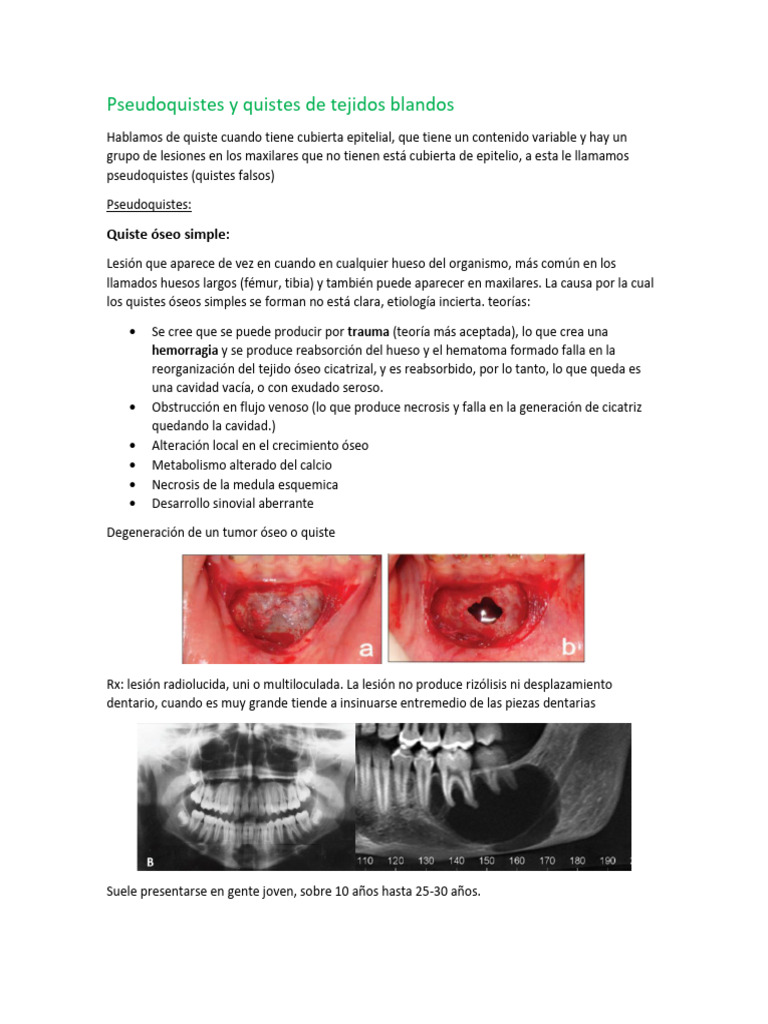 Clase 12. Pseudoquistes y Quistes de Tejidos Blandos | PDF | Hueso ...