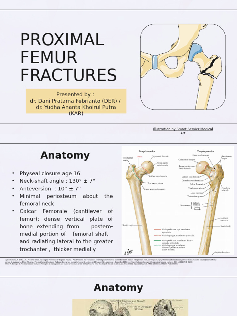 Fracture On Proximal Femur-1 - Rev | PDF | Hip | Orthopedic Surgery