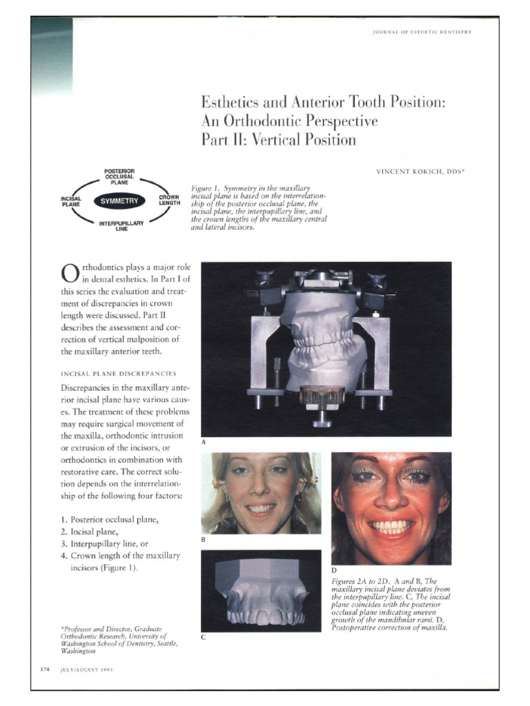 Kokich-Esthetics and Anterior Tooth Position Orthodontic Perspective ...
