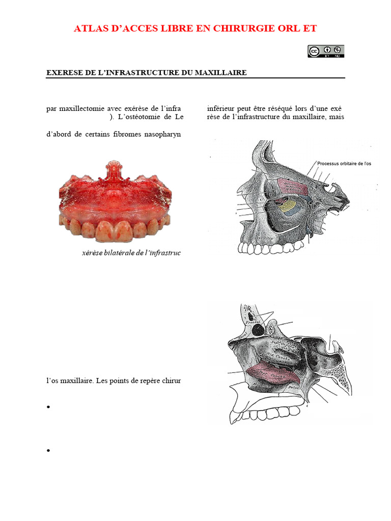 Anatomie et Exérèse du Maxillaire en ORL | PDF | Tête et cou chez l ...