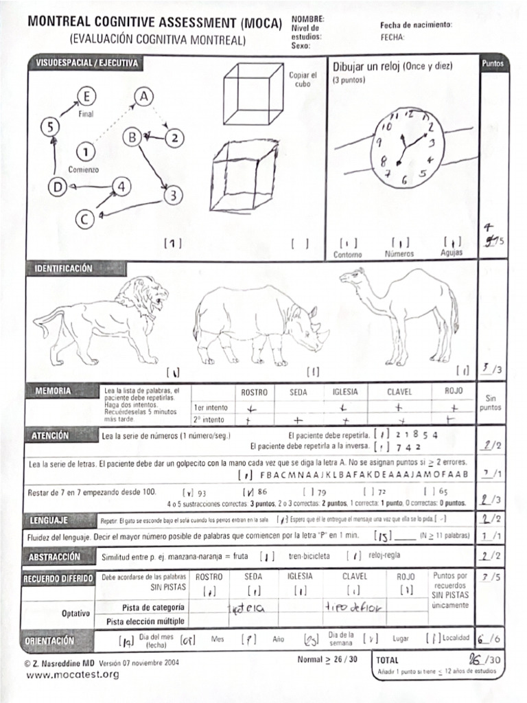 Montreal Cognitive Assessment (Moca) | PDF