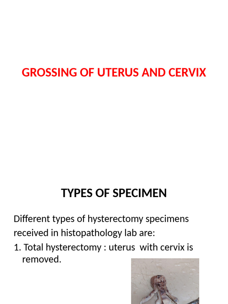 GROSSING OF UTERUS AND CERVIX TUMORS Important | PDF | Uterus | Medical ...