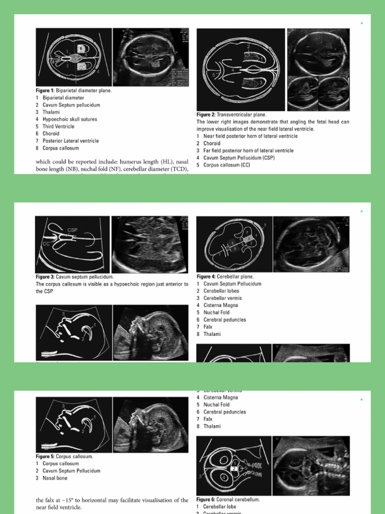 Level 2 Images PDF | PDF