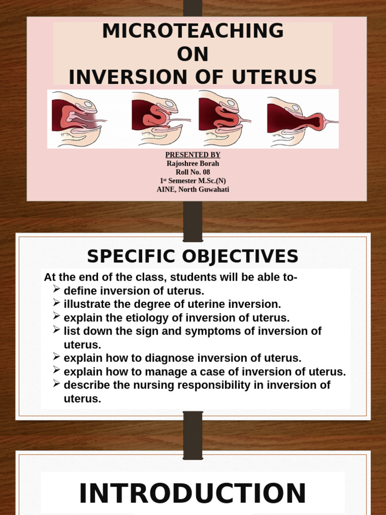 8. Rajoshree Inversion of Uterus | PDF