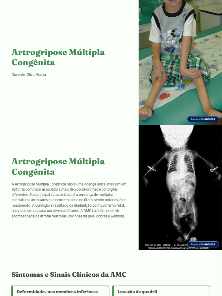 Artrogripose Múltipla Congênita: Causas e Tratamento | PDF ...