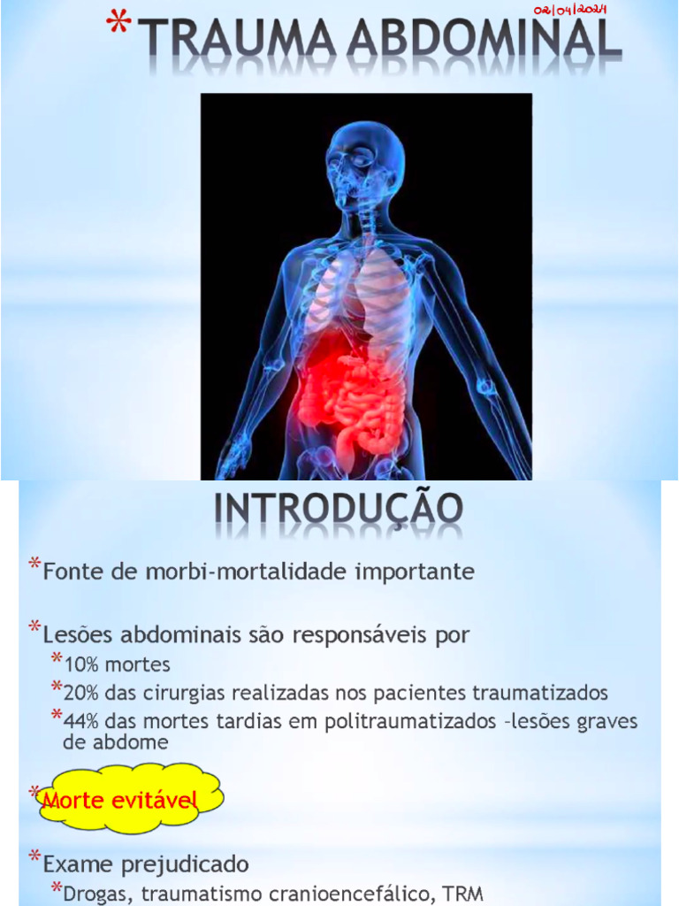 04 - Trauma Abdominal | PDF