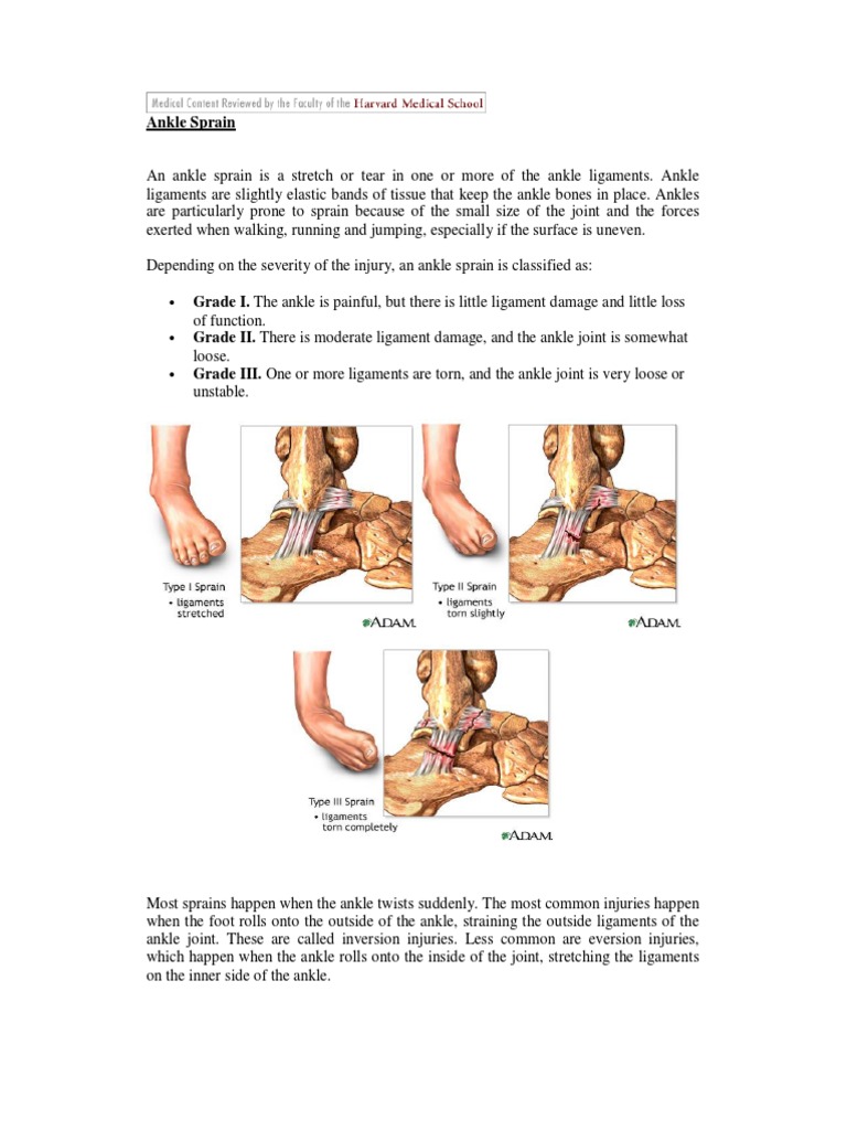 Ankle Sprain Guide | PDF | Ankle | Traumatology