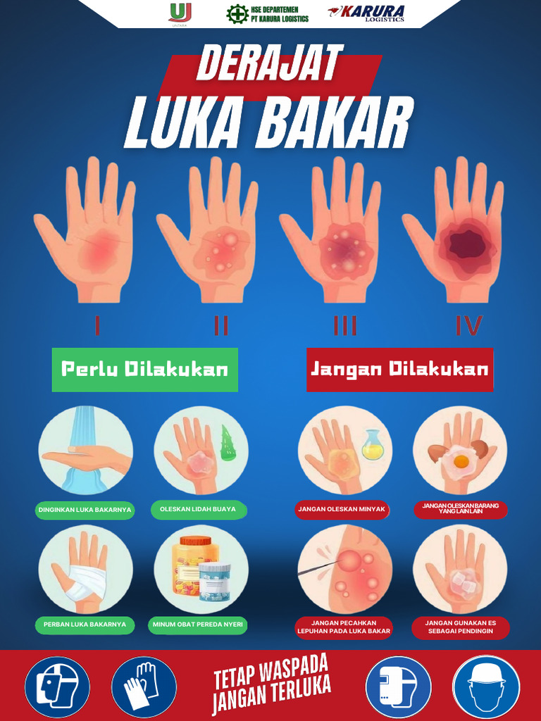 Poster Luka Bakar | PDF