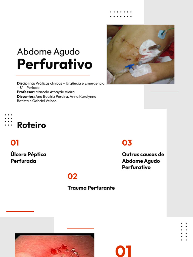 Abdome Agudo Perfurativo: Causas e Tratamento | PDF | Estômago | Fígado