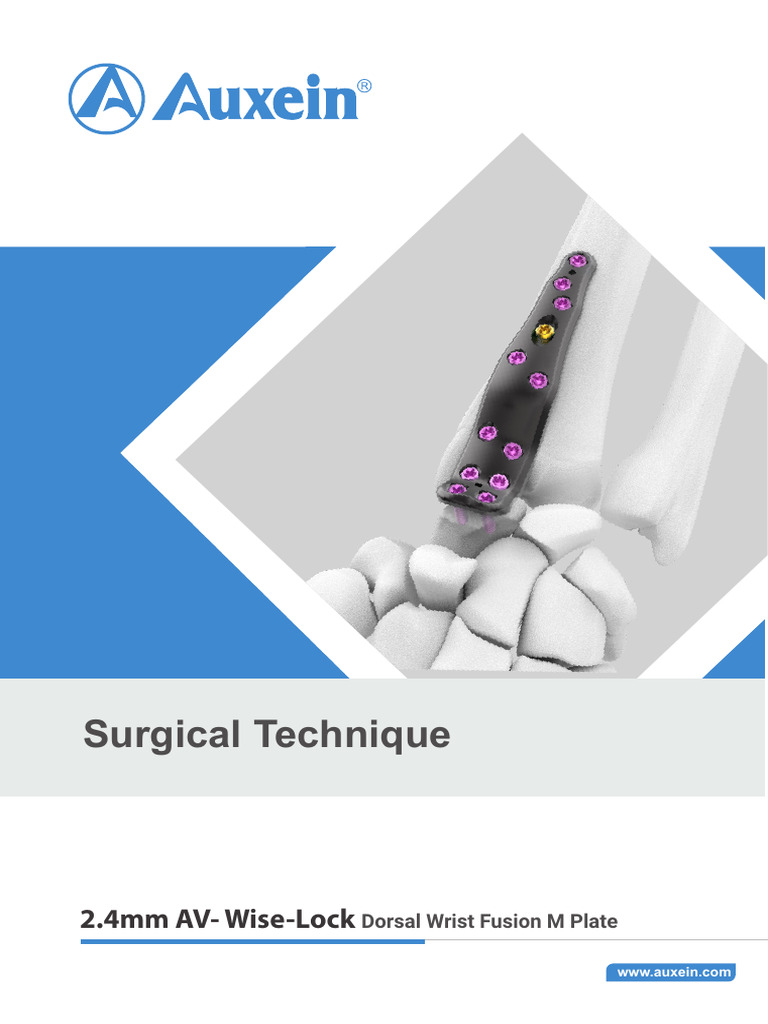 2.4 MM AV Wise Lock Dorsal Wrist Fusion M Plate | PDF | Hand | Screw