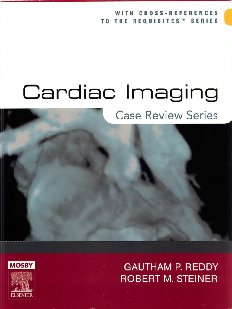 CRS Cardiac Imaging | PDF