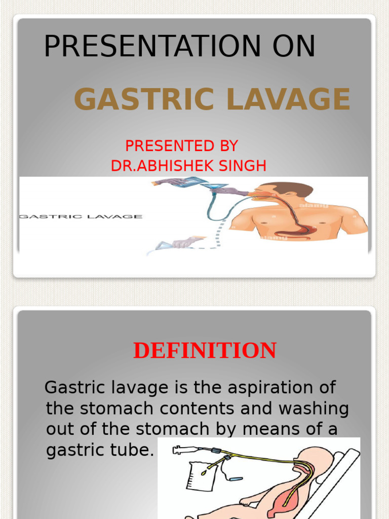 Gastric Lavage Procedure Overview | PDF | Stomach | Clinical Medicine