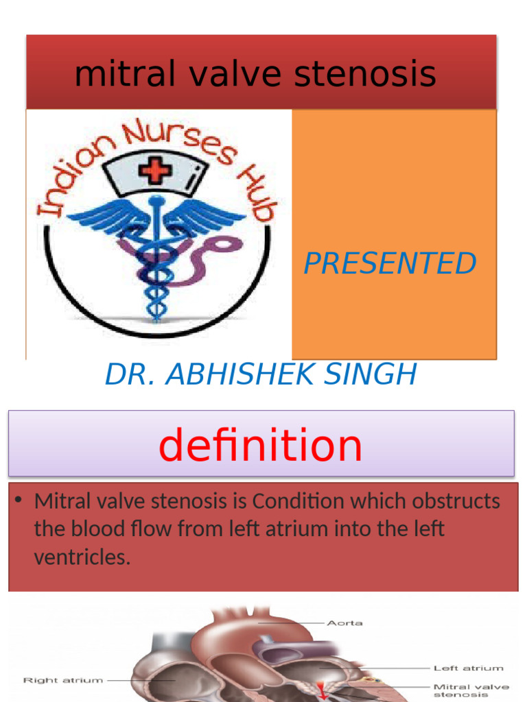 Mitral Valve Stenosis | PDF