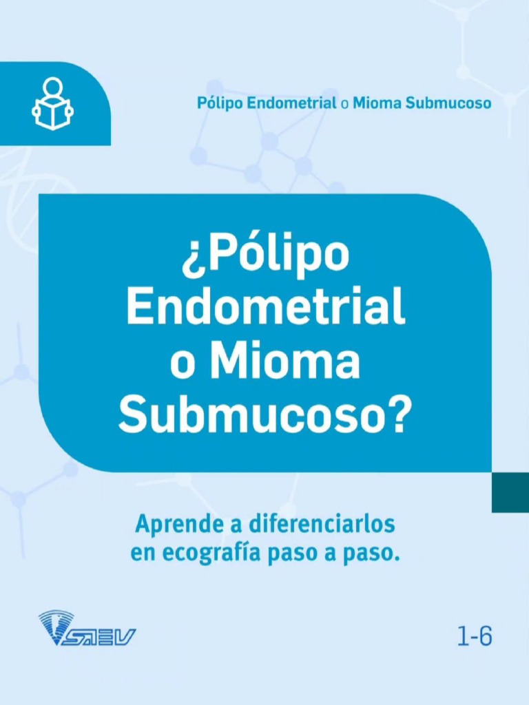 Pólipo Endometrial o Mioma Submucoso | PDF | Ultrasonido médico ...