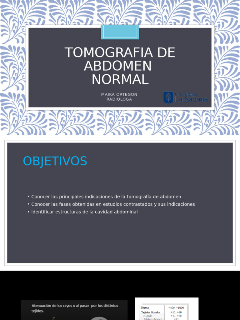 TC Abdomen Normal .PPTX Final | PDF | Abdomen | Hígado