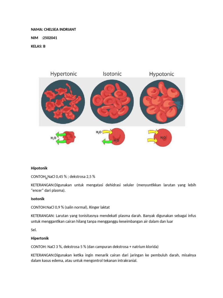 Jenis Larutan Infus: Hipotonik, Isotonik, Hipertonik | PDF