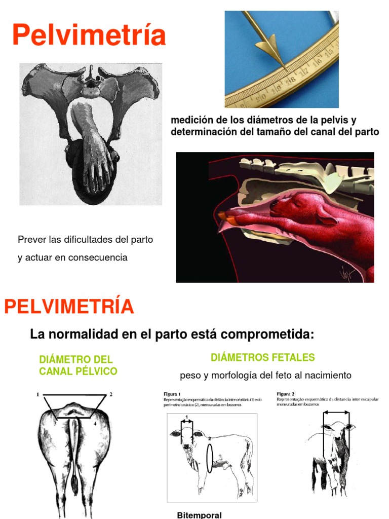 PELVIMETRIA | Pelvis | Anatomía humana