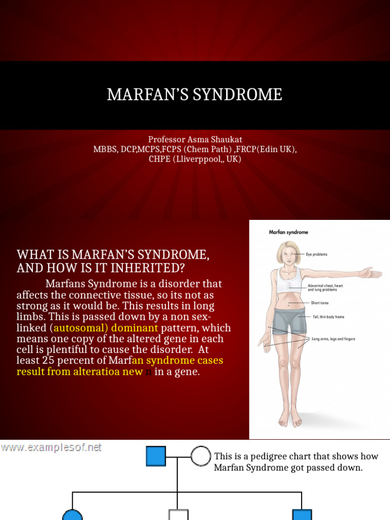 Marfan Syndrome 7th | PDF | Genetic Disorder | Diseases And Disorders