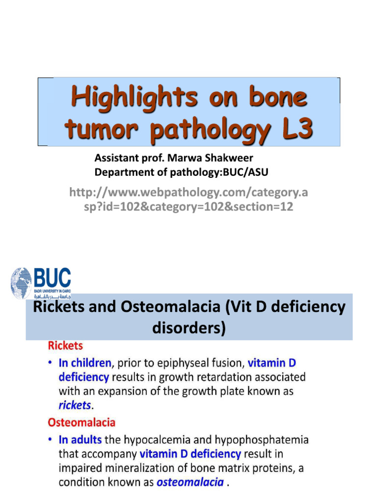 Highlights On Pathology of Bone Tumor | PDF