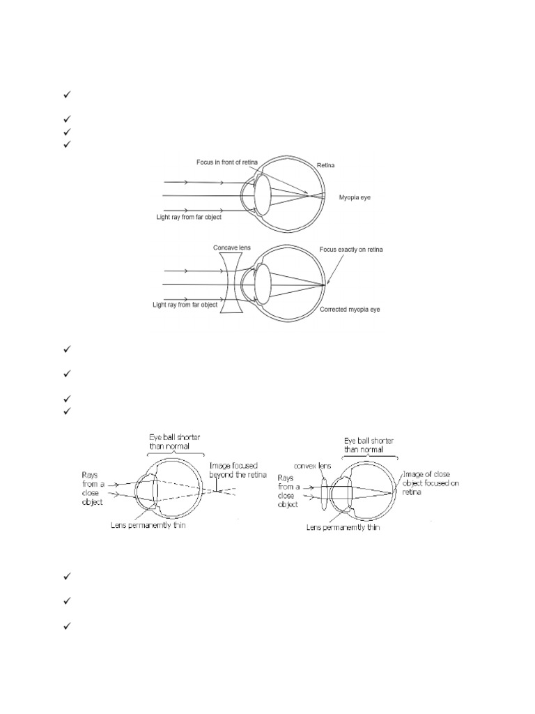 TOPIC 6 Grade 11 Handout Notes Sensory Organs (Eyes and Ears) | PDF ...