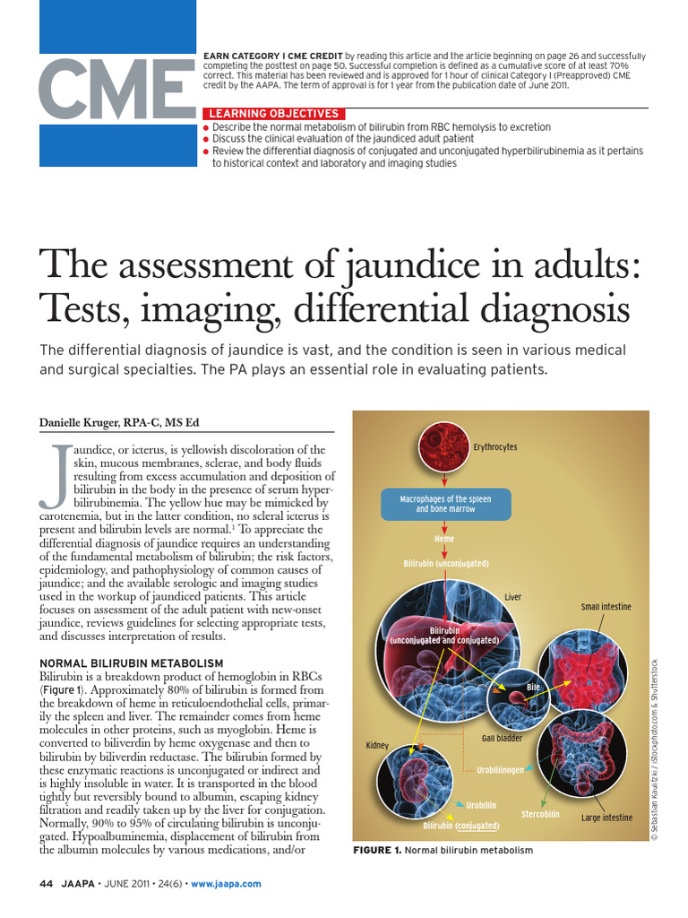 Jaundice in Adults: Diagnosis and Tests | PDF | Hepatitis | Diseases ...