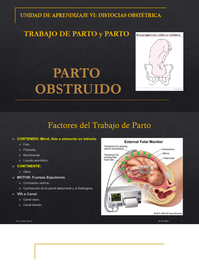 CLASE 36 Parto Obstruido y Precipitado (2025) | PDF | Parto | Salud ...