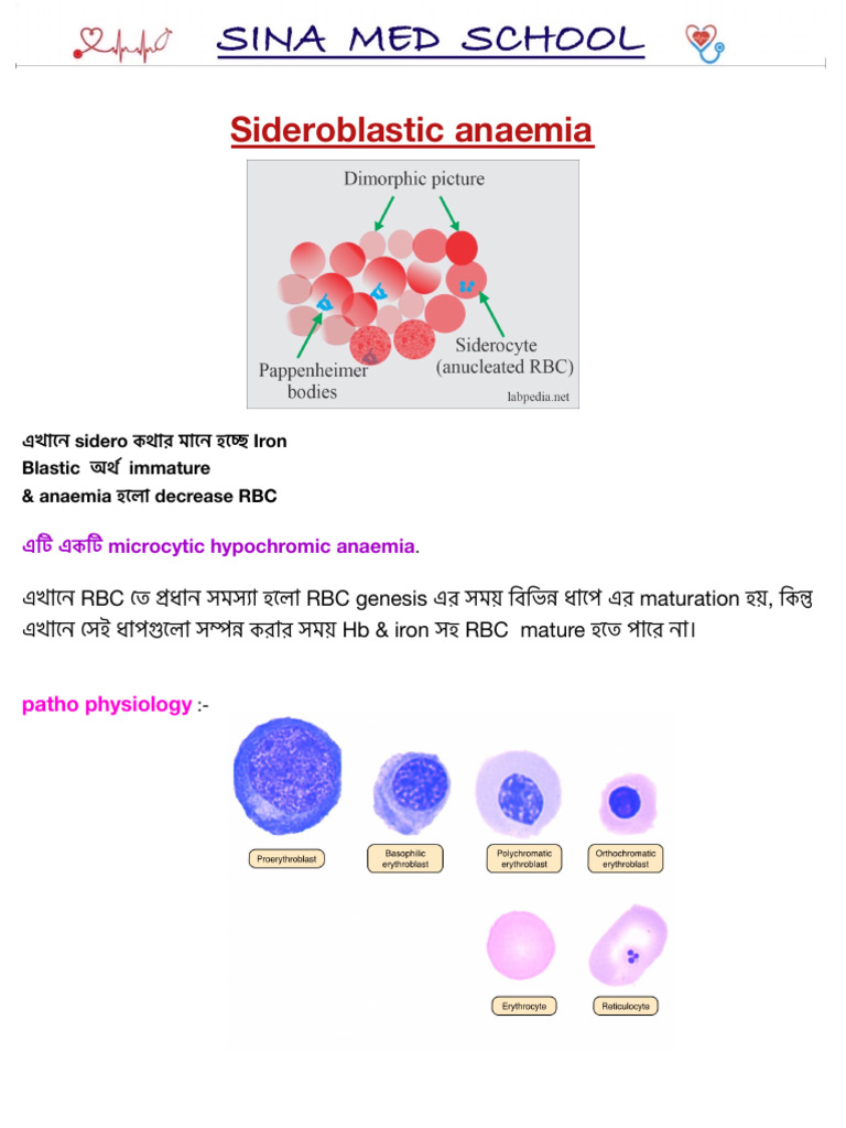 Sideroblastic Anemia | PDF