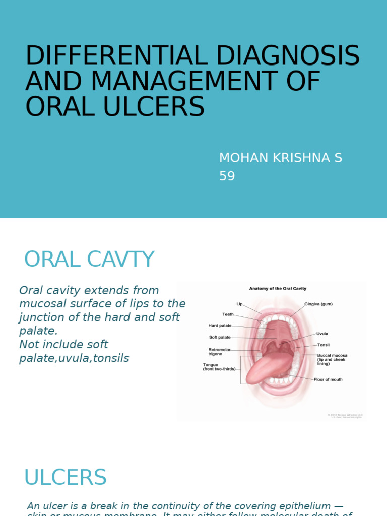 ORAL ulcer-1 is a ppt of oral ulcer which is a ppt | PDF | Diseases And ...