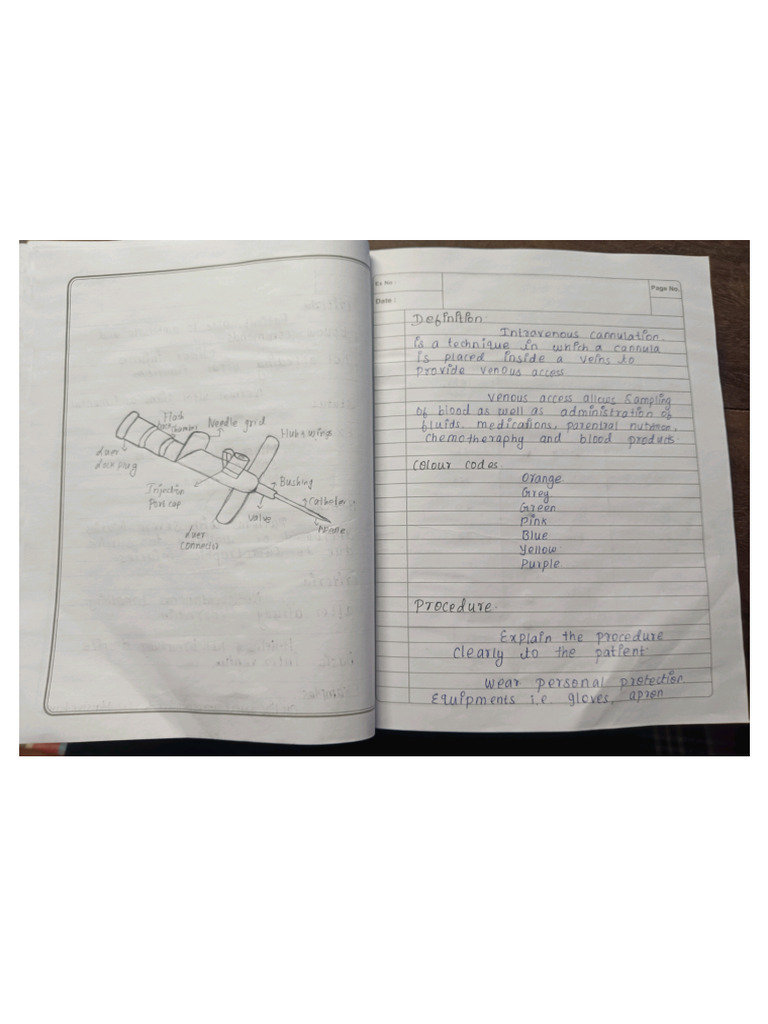 IV Cannula Diagram | PDF