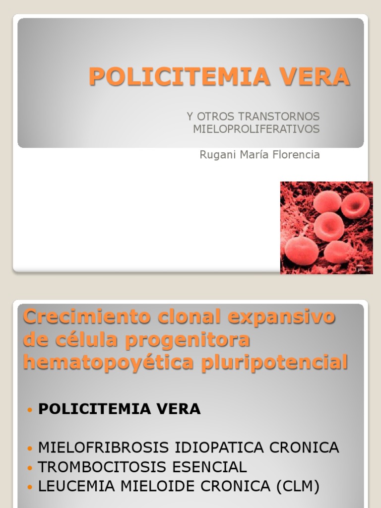 Policitemia Vera | Hematology | Tissue (Biology)