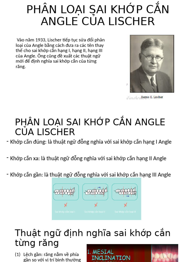 PHÂN LOẠI SAI KHỚP CẮN ANGLE CỦA LISCHER | PDF