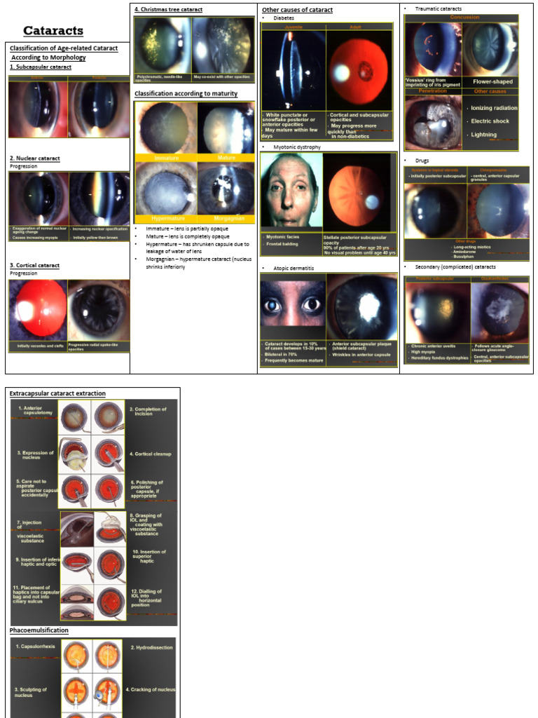 Types and Causes of Cataracts | PDF