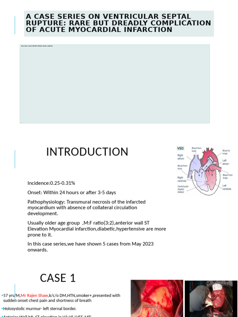 Case Series on Ventricular Septal Rupture (1) | PDF | Myocardial ...