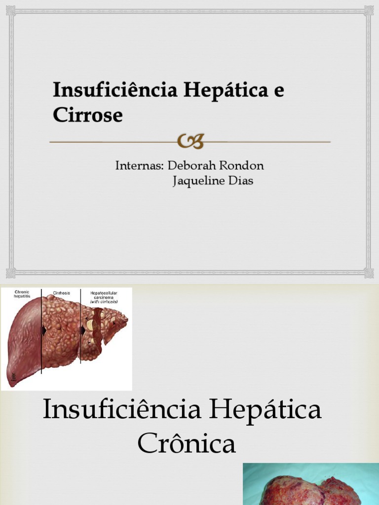 Insuficiência Hepática Aguda e Crônica: Etiologia, Fisiopatologia ...