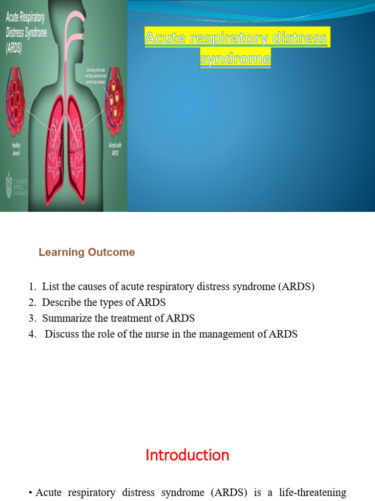 Acute Respiratory Distress Syndrome Guide | PDF | Medical Specialties ...