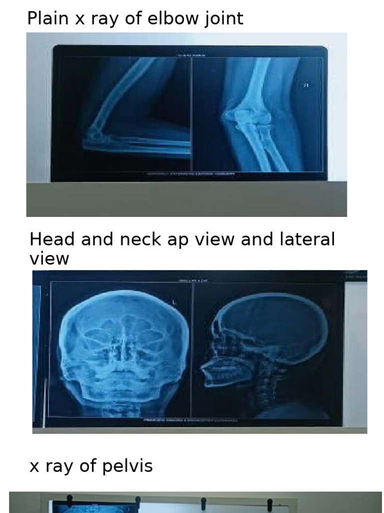 X Rays | PDF