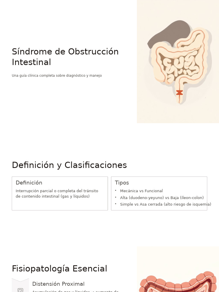 Sindrome de Obstruccion Intestinal | PDF | Enfermedad de Crohn ...