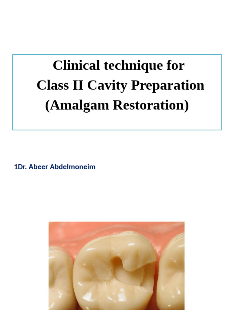 Class II Tooth Preparation For Amalgam Restoration | PDF | Tooth Enamel ...