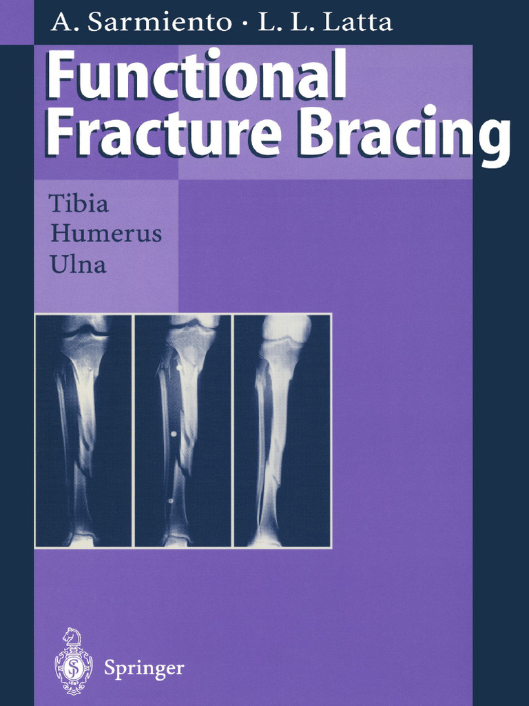 Functional Fracture Bracing Guide | PDF | Orthopedic Surgery | Surgery