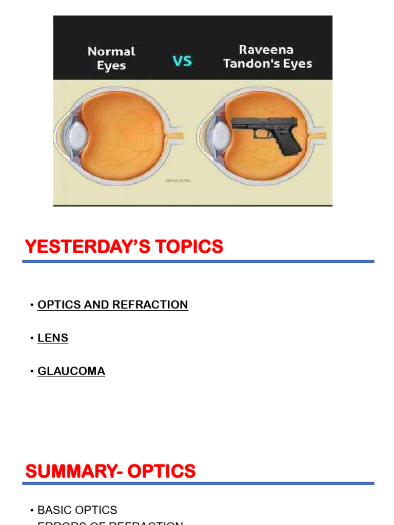Fmge Ophtha Day-2 Unannotated | PDF | Glaucoma | Visual Impairment