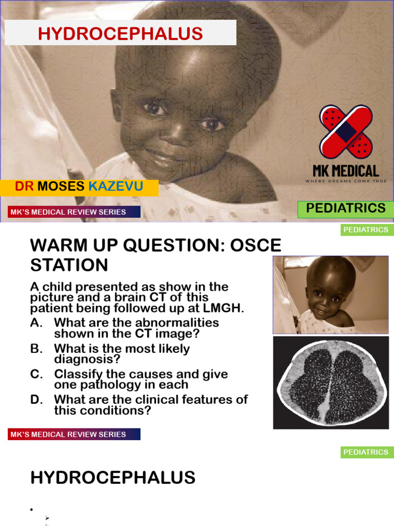 Understanding Hydrocephalus in Pediatrics | PDF | Cerebrospinal Fluid ...
