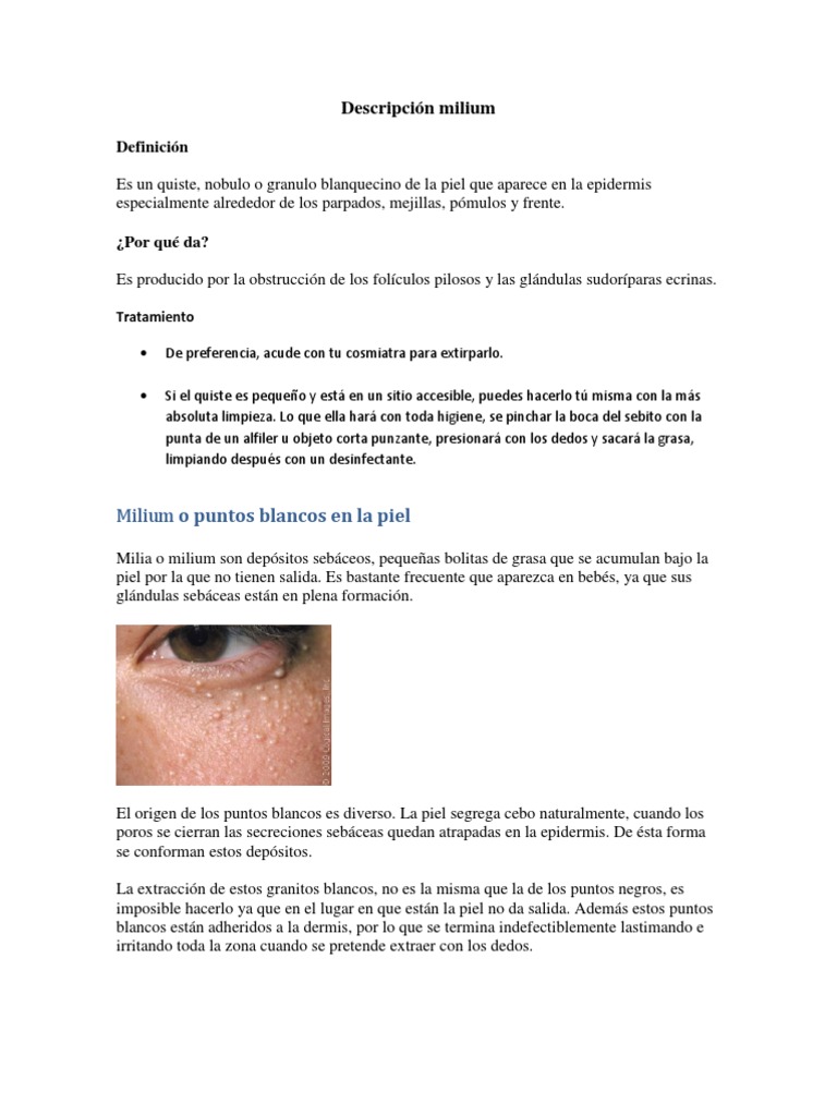 Extracción y tratamiento de milium | PDF | Órganos sensoriales | Piel